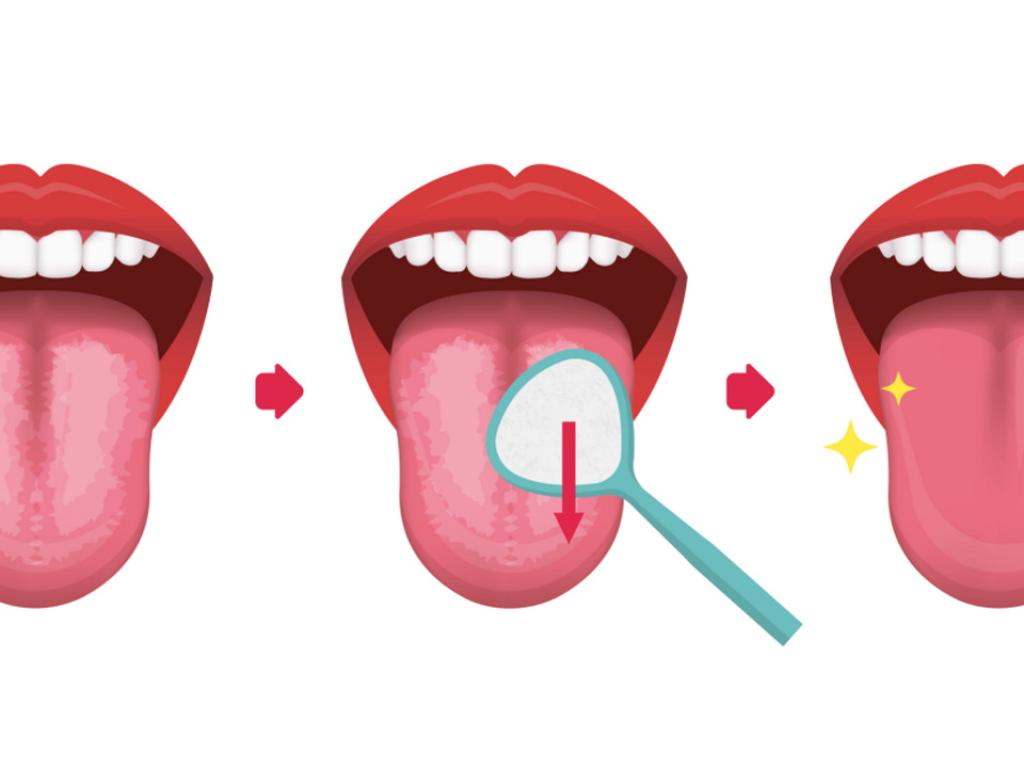 Мъж се сдоби с черен космат език след прекаран инсулт - Свят - Vesti.bg